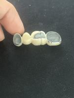 China Precision Fit Durable Key and Keyway for Secure Insertion in Mechanical Applications for sale