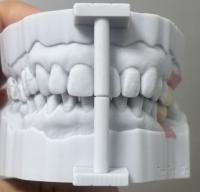 China Full Zirconia Screw Retained Abutment for Implant Supported Dental Restoration for sale