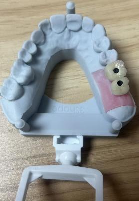 China Full Zirconia Screw Retained Abutment for Implant Supported Dental Restoration for sale