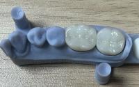 China Full Zirconia Dental Zirconia Material with High Strength and Biocompatible Properties for sale