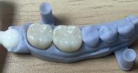 China Full Zirconia Dental Zirconia Material with High Strength and Biocompatible Properties for sale