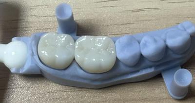 China Full Zirconia Dental Zirconia Material with High Strength and Biocompatible Properties for sale