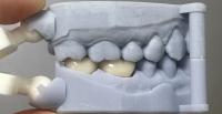 China Full Zirconia Dental Zirconia Material with High Strength and Biocompatible Properties for sale