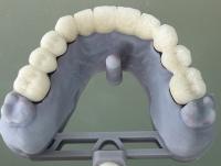 China Semi-precious Porcelain Fused to Metal Dental Bridge for Durable Dental Restoration for sale