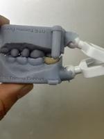 China Full Zirconia Dental Restorations High Strength • Natural Aesthetics • Long-Lasting Comfort for sale