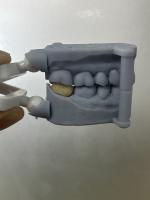 China Full Zirconia Dental Restorations High Strength • Natural Aesthetics • Long-Lasting Comfort for sale