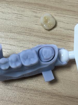 China Full Zirconia Dental Restorations High Strength • Natural Aesthetics • Long-Lasting Comfort for sale