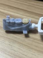 China Full Zirconia Dental Restorations High Strength • Natural Aesthetics • Long-Lasting Comfort for sale