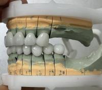China Full Zirconia dental bridge for high strength and durable dental restoration for sale