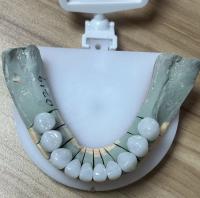 China Full Zirconia dental bridge for high strength and durable dental restoration for sale