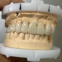 China Full Zirconia dental bridge for high strength and durable dental restoration for sale
