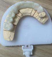 China Full Zirconia dental bridge for high strength and durable dental restoration for sale