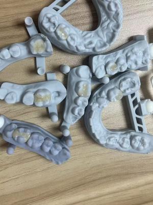 China Emax Inlay and Onlay Dental Restoration with Natural Teeth Color, Minimal Preparation, and High Translucency for sale