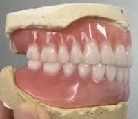 China Full Arch Denture for sale