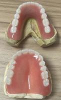 China Full Arch Denture for sale