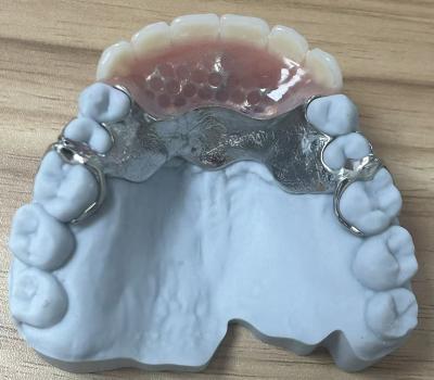 China Metal Framework with acrylic partial denture finish for sale