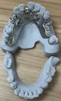 China Cast Partial Denture Framework for sale