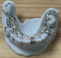 China Cast Partial Denture Framework for sale