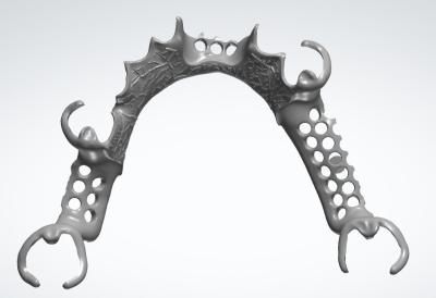 China Digital Metal Frame for Precision Applications and Durable Construction for sale