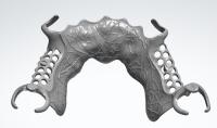 China Digital Metal Frame for Precision Applications and Durable Construction for sale