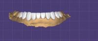 China Precision Fit Digital Wax Up Dental Study Model with Durable and Biocompatible 3D Printed Design for sale