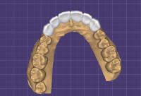 China Precision Fit Digital Wax Up Dental Study Model with Durable and Biocompatible 3D Printed Design for sale