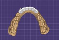 China Precision Fit Digital Wax Up Dental Study Model with Durable and Biocompatible 3D Printed Design for sale