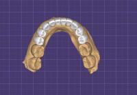 China Precision Fit Digital Wax Up Dental Study Model with Durable and Biocompatible 3D Printed Design for sale