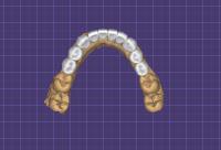 China Precision Fit Digital Wax Up Dental Study Model with Durable and Biocompatible 3D Printed Design for sale