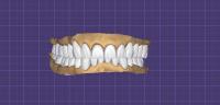 China Precision Fit Digital Wax Up Dental Study Model with Durable and Biocompatible 3D Printed Design for sale