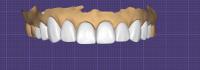 China Precision Fit Digital Wax Up Dental Study Model with Durable and Biocompatible 3D Printed Design for sale
