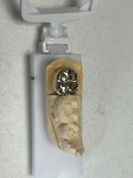China Gold Crown Dental Crown with Gold Material, Durable and Aesthetic Finish for Restoration for sale