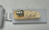 China Gold Crown Dental Crown with Gold Material, Durable and Aesthetic Finish for Restoration for sale