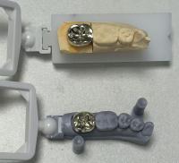 China Gold Crown Dental Crown with Gold Material, Durable and Aesthetic Finish for Restoration for sale