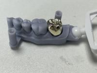 China Gold Crown Dental Crown with Gold Material, Durable and Aesthetic Finish for Restoration for sale