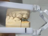 China Gold Crown Dental Crown with Gold Material, Durable and Aesthetic Finish for Restoration for sale