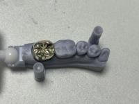 China Gold Crown Dental Crown with Gold Material, Durable and Aesthetic Finish for Restoration for sale