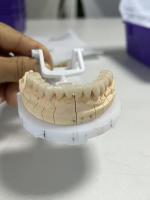 China Full Zirconia Dental Crown - Biocompatible High Strength Zirconia Dental Restoration for sale