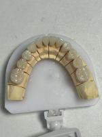 China Full Zirconia Dental Crown - Biocompatible High Strength Zirconia Dental Restoration for sale