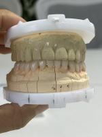 China Full Zirconia Dental Crown - Biocompatible High Strength Zirconia Dental Restoration for sale