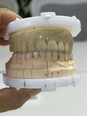 China Full Zirconia Dental Crown - Biocompatible High Strength Zirconia Dental Restoration for sale