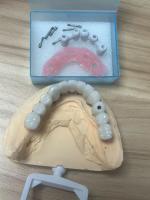 China Full Zirconia Dental Crown with Abutment - Biocompatible and High Strength Zirconia Material for sale