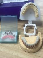 China Full Zirconia Dental Crown with Abutment - Biocompatible and High Strength Zirconia Material for sale