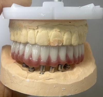 China Full Zirconia Dental Crown with Abutment - Biocompatible and High Strength Zirconia Material for sale