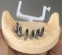 China Full Zirconia Dental Crown with Abutment - Biocompatible and High Strength Zirconia Material for sale