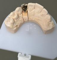 China Gold Open Window Crown for sale