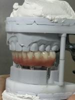 China Monolithic Zirconia Implant Bridge for Full Arch Restoration with CAD/CAM Precision for sale