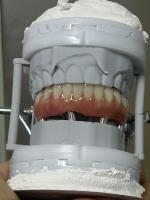 China Monolithic Zirconia Implant Bridge for Full Arch Restoration with CAD/CAM Precision for sale