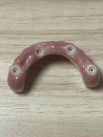 China Monolithic Zirconia Implant Bridge for Full Arch Restoration with CAD/CAM Precision for sale