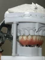 China Monolithic Zirconia Implant Bridge for Full Arch Restoration with CAD/CAM Precision for sale